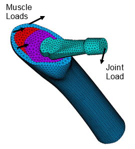 Stress Analysis of a Total Hip Replacement